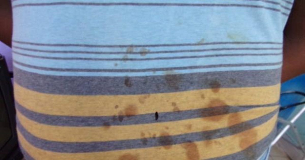 Disidente Edelvis Granda luego de ser herido por un policía